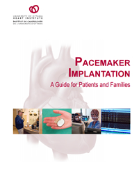 Pacemaker Implantation Patient Guide - University of Ottawa Heart Institute