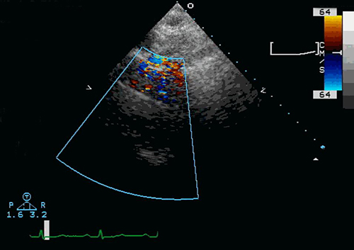 Echocardiogram | University of Ottawa Heart Institute