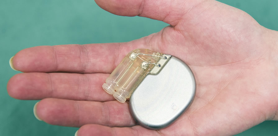 Pacemaker/ICD Bleeding Complication Increases Risk of Serious ...