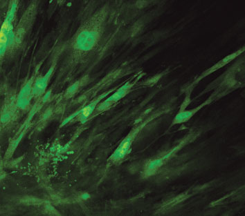 Helping the Heart Heal Itself: The Promise of Regenerative Medicine ...