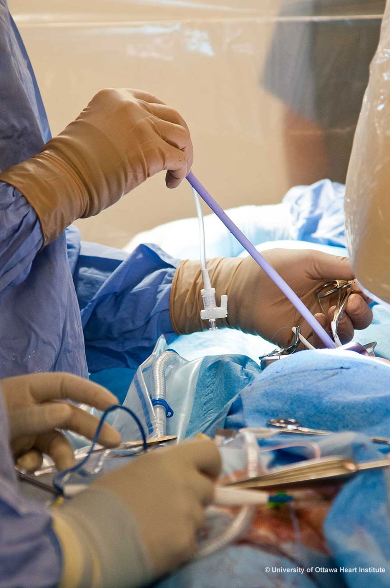 Transcatheter Aortic Valve Implantation Gallery | University of Ottawa ...