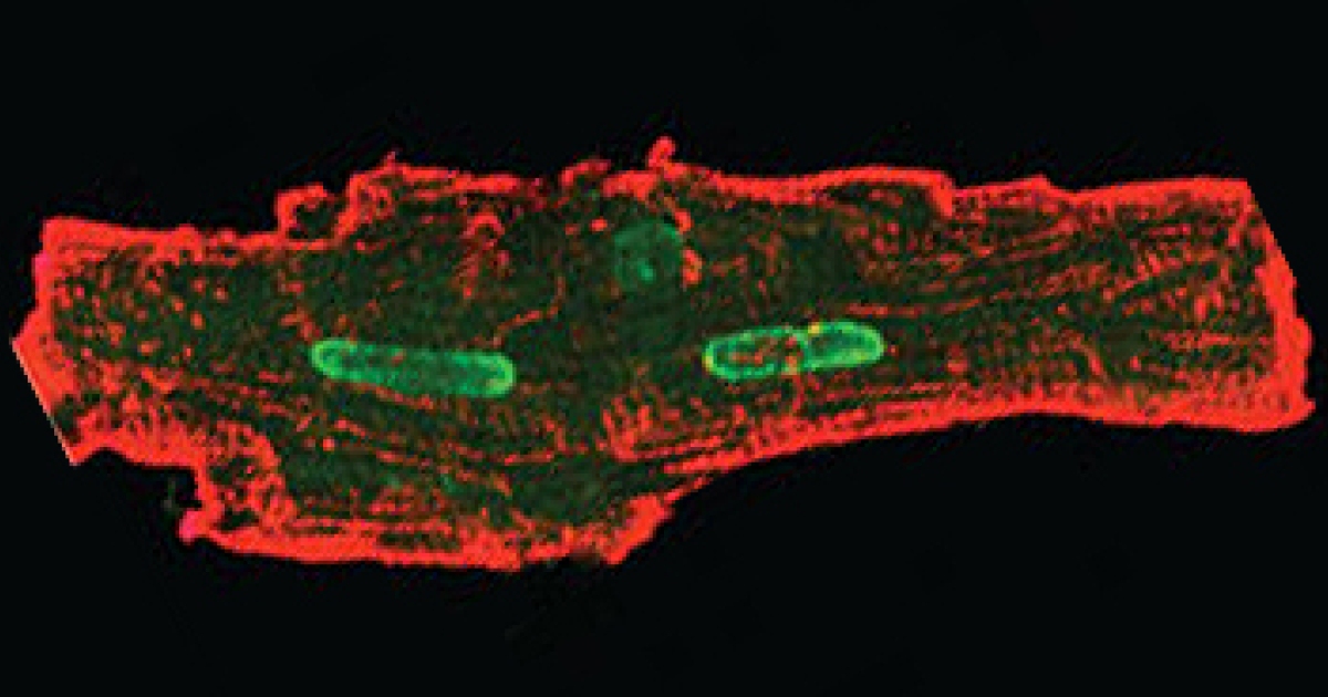 AHA 2011: UOHI Research Named among Top 5 Canadian Abstracts ...