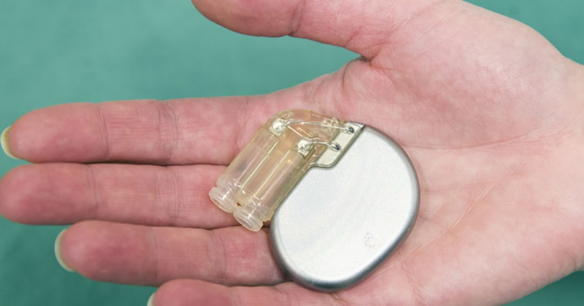 Pacemaker/ICD Bleeding Complication Increases Risk of Serious ...