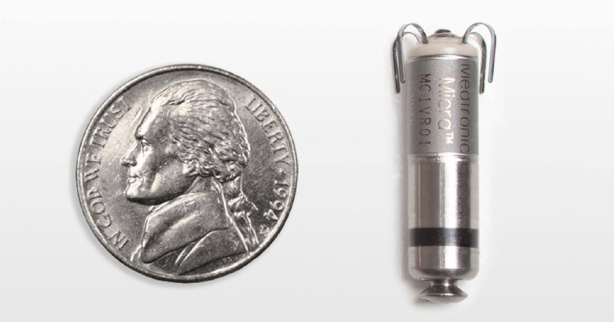 The leadless pacemaker: Is wireless pacing the new era of cardiac care ...